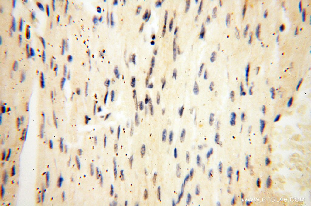 VSIG1 Fusion Protein Ag6625 | Proteintech