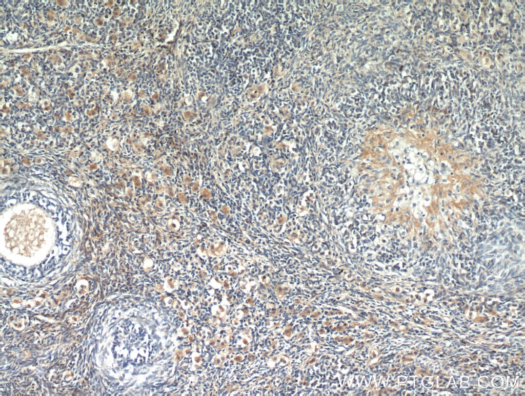 HE4 Fusion Protein Ag5936 | Proteintech