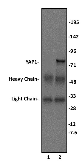 YAP1 antibody (pAb) | Proteintech