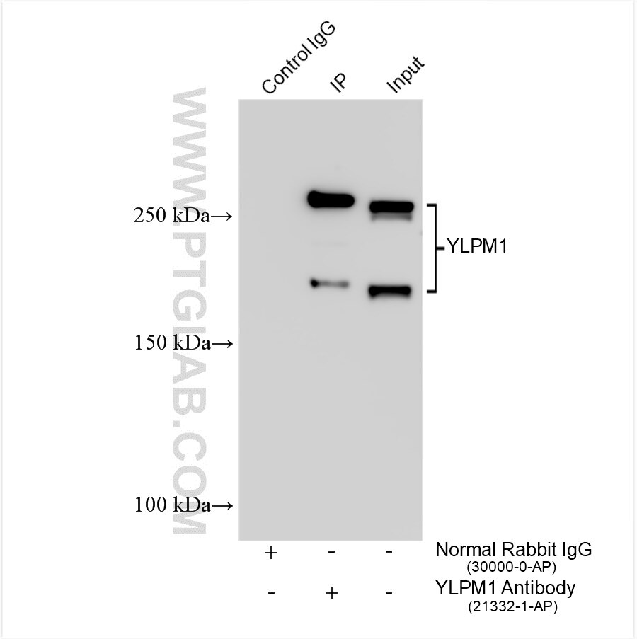 YLPM1 antibody (21332-1-AP) | Proteintech