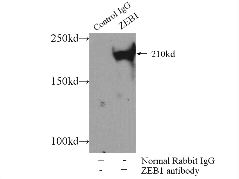 ZEB1 antibody (21544-1-AP) | Proteintech
