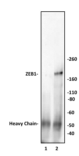 ZEB1 antibody (pAb) | Proteintech