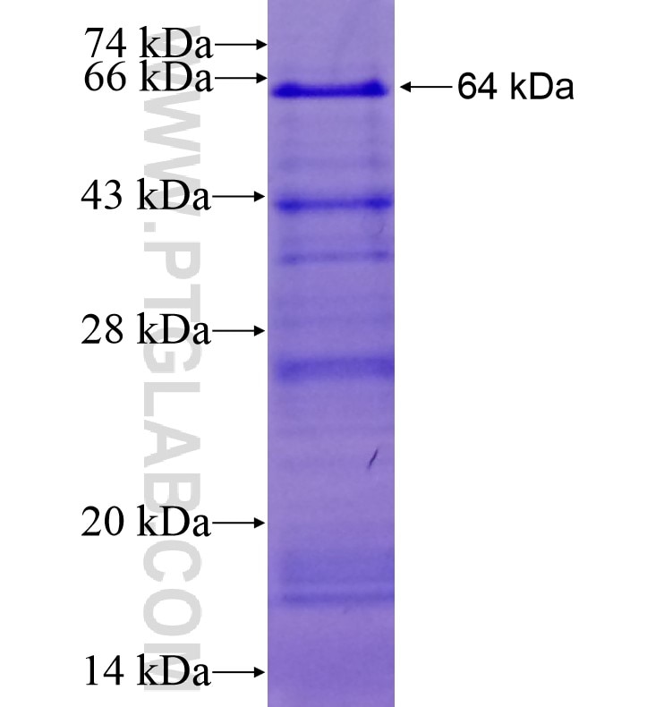 ZNF274 Fusion Protein Ag16295 | Proteintech